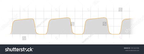 Capnography Waveform Monitoring Normal Curve Stock Illustration 1931261036 Shutterstock