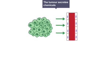Virus Diagram Gcse Cancer And Carcinogens Non Communicable Diseases