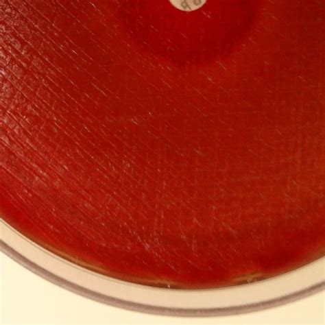 Bacitracin Sensitive Isolate Download Scientific Diagram