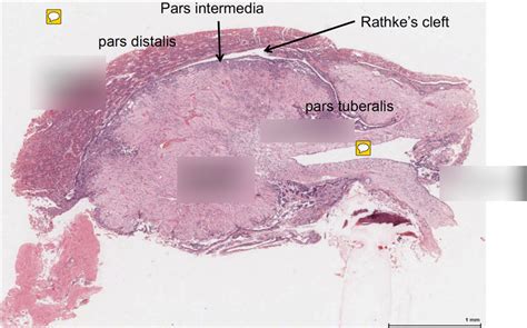 Histology Endocrinology Pituitary Gland Diagram Quizlet