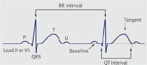 The QT Interval Is Measured From The Onset Of The Q Wave To The End Of Download Scientific