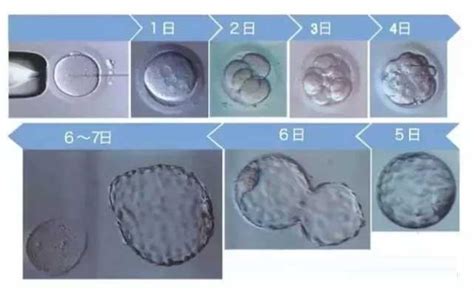 试管婴儿囊胚培养阶段与分级 知乎