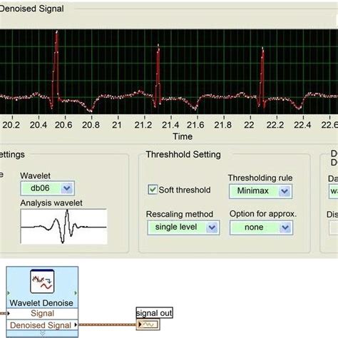 Typical Ecg Signal Processing Flowchart Download Scientific Diagram