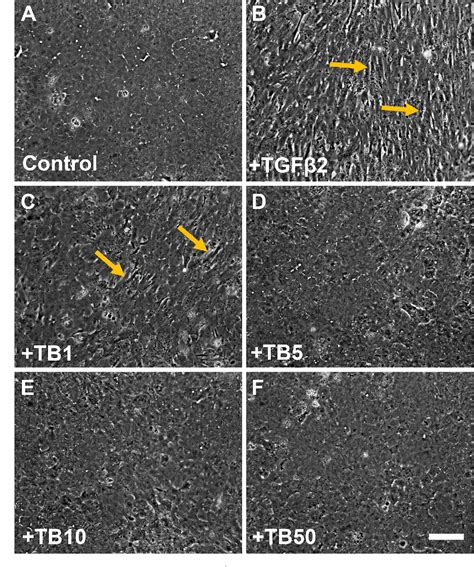 Figure 1 From Bone Morphogenetic Protein 7 Suppresses Tgfβ2 Induced Epithelial Mesenchymal