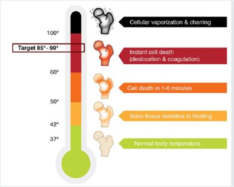 Radiofrequency Ablation For Atypical Cartilaginous Tumors Is Safe And Effective Analysis Of 189