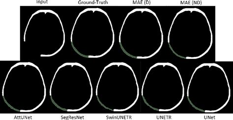 Figure 3 From Automatic Cranial Defect Reconstruction With Self