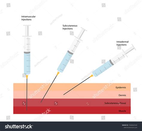 Needle Angles At Mariann Cochran Blog