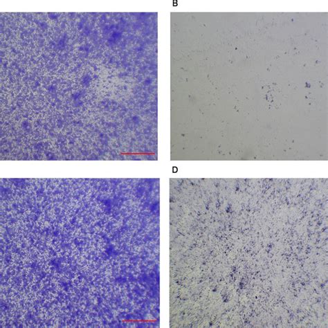 Light Micrographs 100× Magnification Scale Bars 100 μm Of Download Scientific Diagram