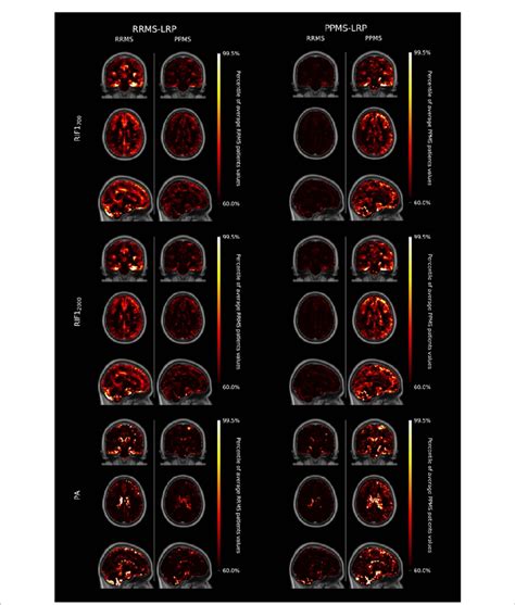 Lrp Heatmaps Obtained From Cnns Models Based On The First Rotation Download Scientific Diagram