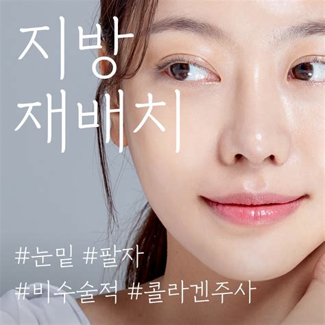 비수술적 지방재배치and콜라겐주사 할인 가격 후기 전후 효과 정보 By Vs라인의원압구정점 여신티켓 국내 1등