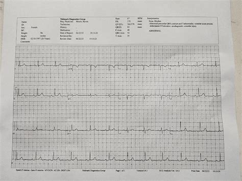 Ecg Reading Abnormal R Readmyecg
