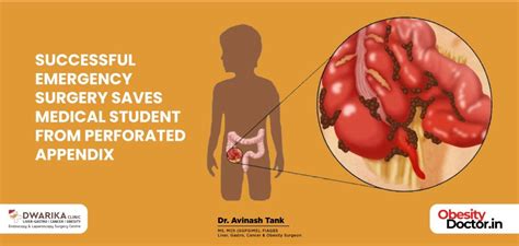 Successful Emergency Surgery Saves Medical Student From Perforated Appendix Dr Avinashtank Is