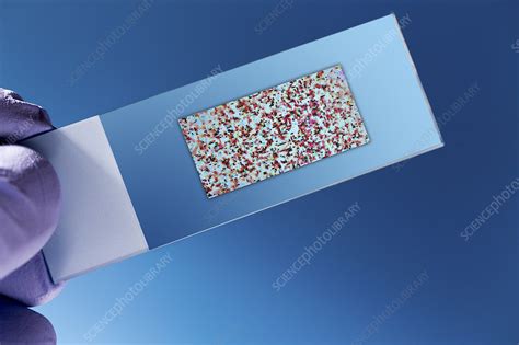 Dna Biochip Stock Image F011 4268 Science Photo Library