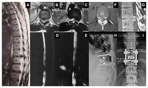 Magnetic Resonance Imaging Mri T2 Sagittal A T1 Axial B T2