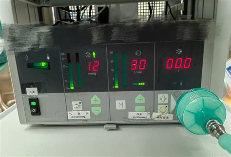 Laparoscopic Anatomical Liver Segment Vii Resection With Liver Parenchymal Transection Following