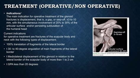 Upper Extremity Fracture Principles Ppt
