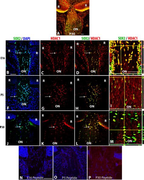 Hdac1 Localization Pattern In Developing Murine Optic Nerve A Low