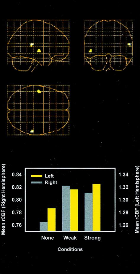 Reactivation Of Encoding Related Brain Activity During Memory Retrieval Pnas