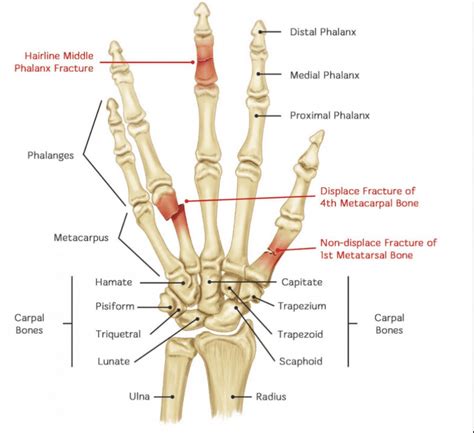 Metacarpals Labeled
