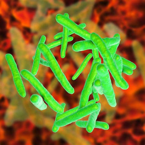 Best Leprosy Illustrations Royalty Free Vector Graphics And Clip Art