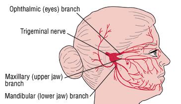 Trigeminal Neuralgia Treatment In Orange County CA