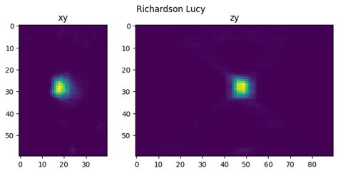 Deconvolution Vs Ai Deblurring For Microscopy Image Analysis Imagesc Forum