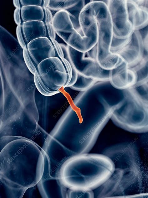Human Appendix Stock Image F016 3044 Science Photo Library