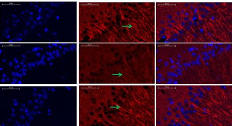Map2 Immunohistochemistry Staining In Hippocampal Ca1 Region Of 2 Vo Download Scientific