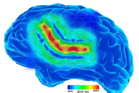 A Curved Excitation Locus Using The Dense Array Is Synthesized And