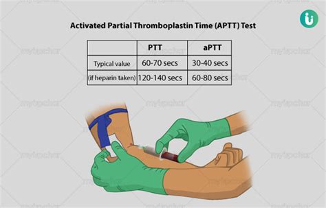 Aptt Activated Partial Thromboplastin Time Test Procedure Purpose Results Normal Values