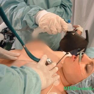 Surgery Digital02 Com