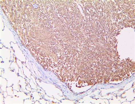 Aspergillus Antibody Rbt A Fumi Bio Sb