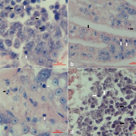 Histopathological Features Of Davidsons Alcohol Formalin Acetic Acid Download Scientific