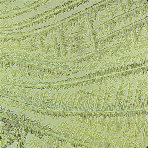 Fern Test Overview Appearance And Clinical Significance