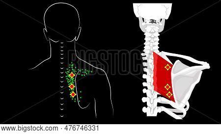 Trigger Points Image Photo Free Trial Bigstock