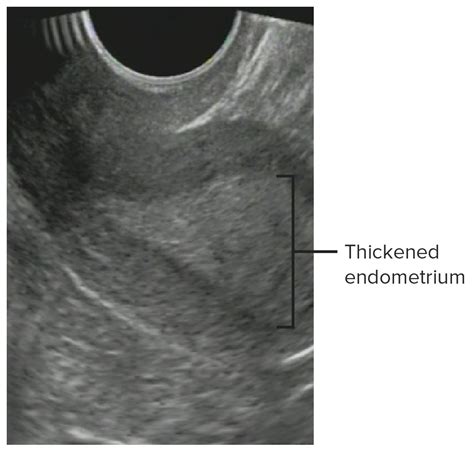 Gynecological Imaging Concise Medical Knowledge