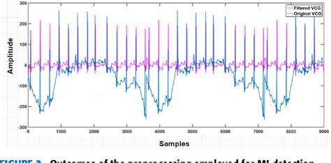 Figure 1 From Cross Subject Myocardial Infarction Detection From Vectorcardiogram Signals Using