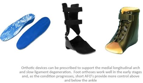 Shoe Insert Posterior Tibial Tendon Dysfunction