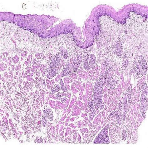 Oral Cavity Histology