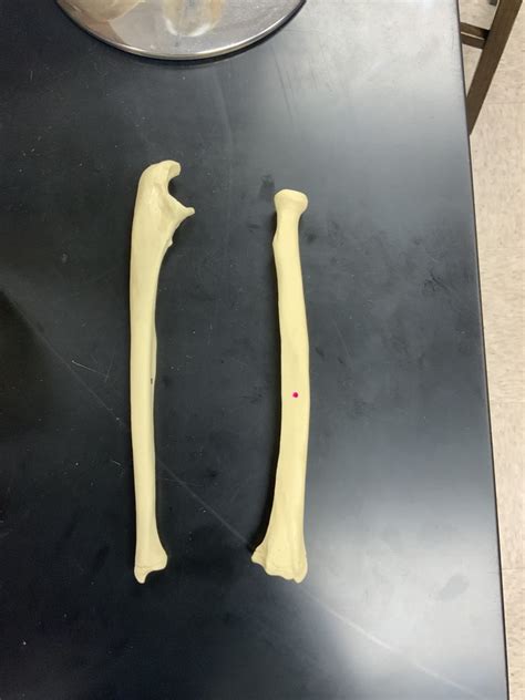 Lab Midterm Radius Ulna Diagram Quizlet