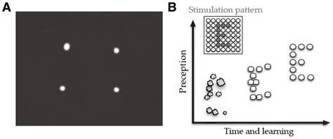 Clinical Progress And Optimization Of Information Processing In Artificial Visual Prostheses