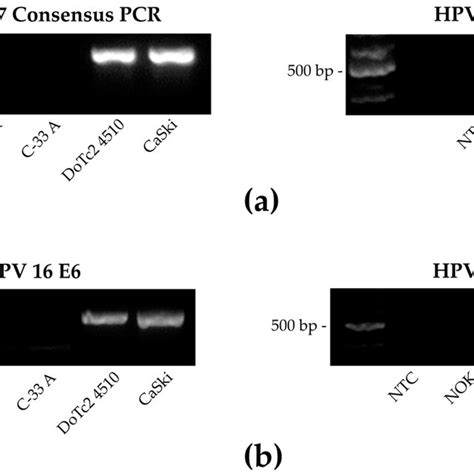 Expression Of Hpv16 E6 And E7 Oncoproteins And Affected Downstream