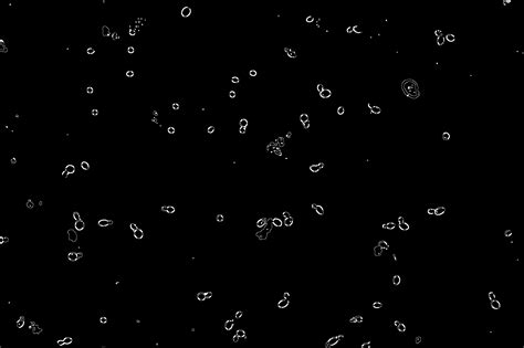 Detecting Circularelliptical Shape With Python Opencv Or Any Other Lib Stack Overflow