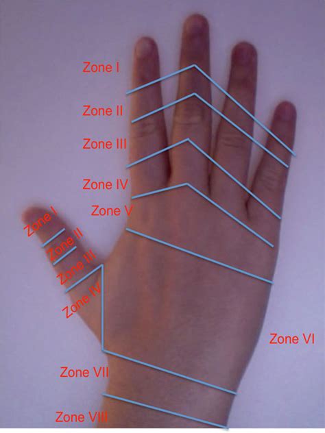 Extensor Tendon Compartments Hand Orthobullets