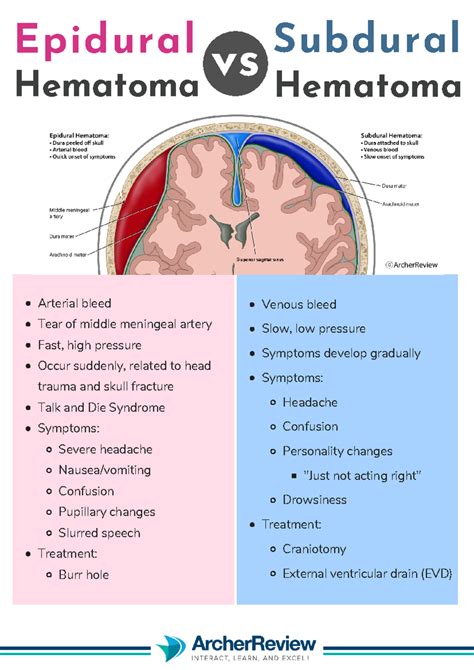 Subdural Hematoma Vs Epidural Hematoma Eroppa