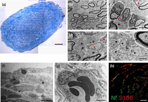 A‐h Qualitative Morphological Examination Of Regenerated Median Nerve Download Scientific