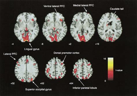 Brain Activity During The Encoding Retention And Retrieval Of