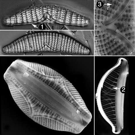 Epithemia Genera Diatoms Of North America