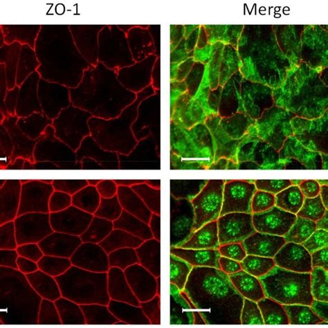 Osmolality Has An Impact On Cell Morphology Imcd Cells Were Cultivated Download Scientific