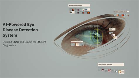 Ai Powered Eye Disease Detection System By Siva Balan On Prezi